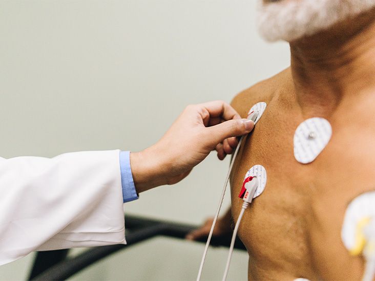 Aortic root aneurysm: Symptoms, treatment, and more