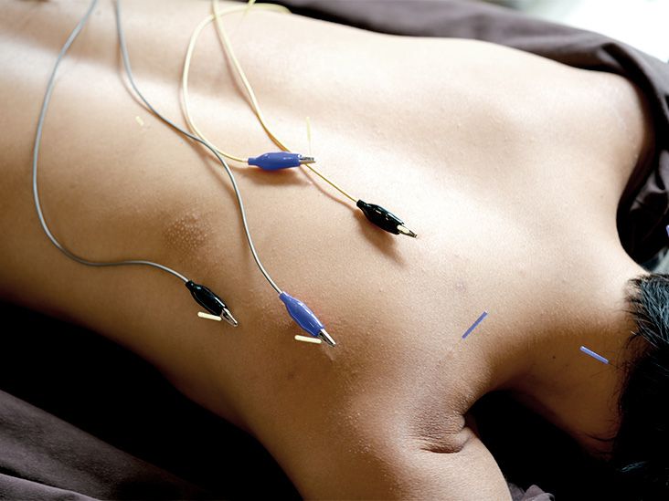 Male Fertility Acupuncture Points Can Pressure Points Relieve