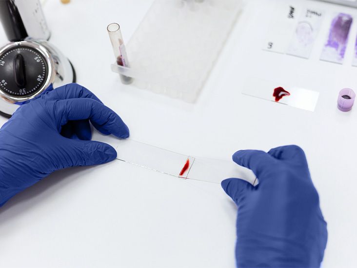 Hepatitis A, AB total reactive: What does it mean?