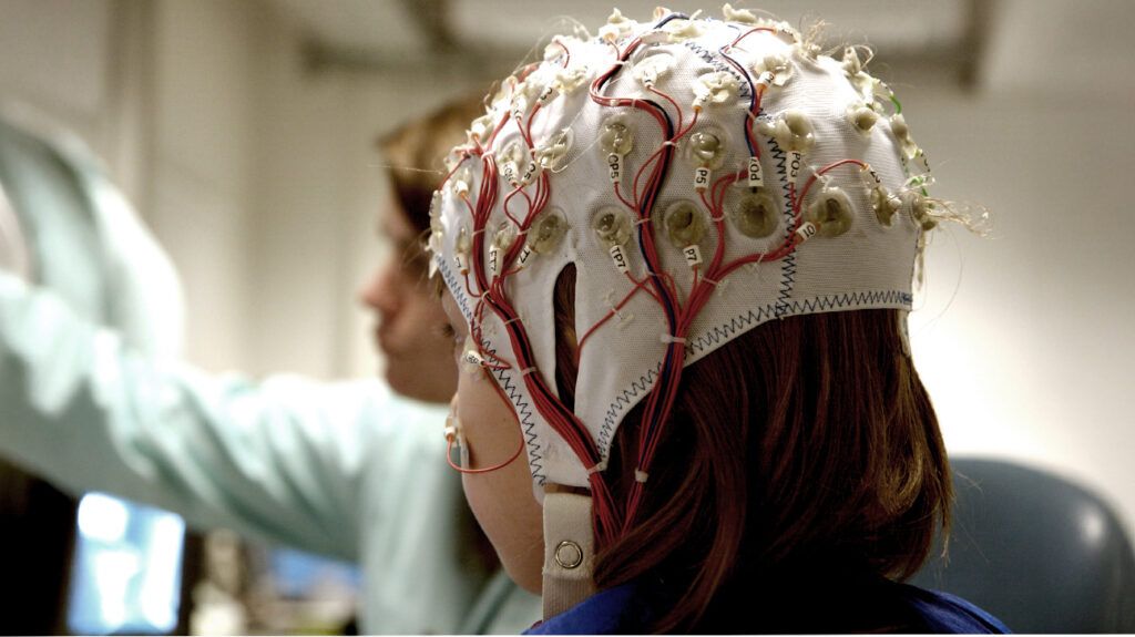 Doose syndrome: Symptoms, causes, and treatment