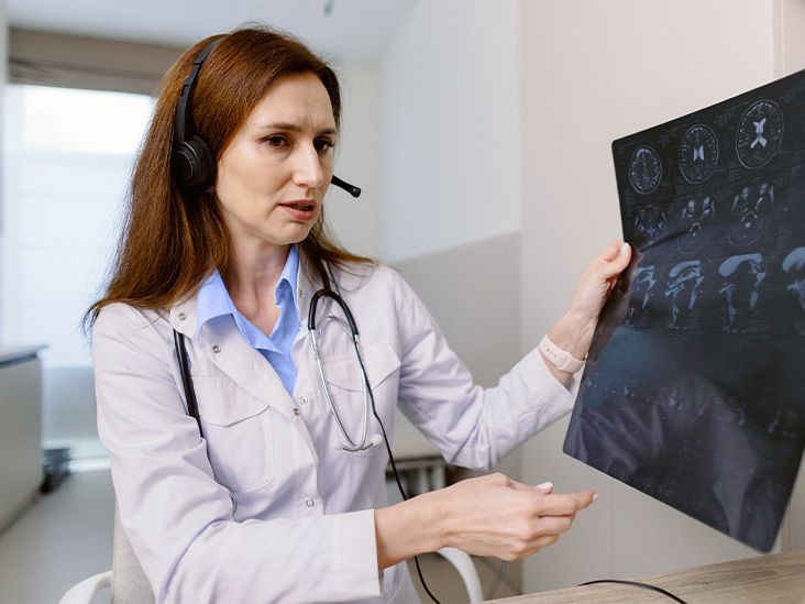 Epilepsy doctor: Types, how to find one, and more