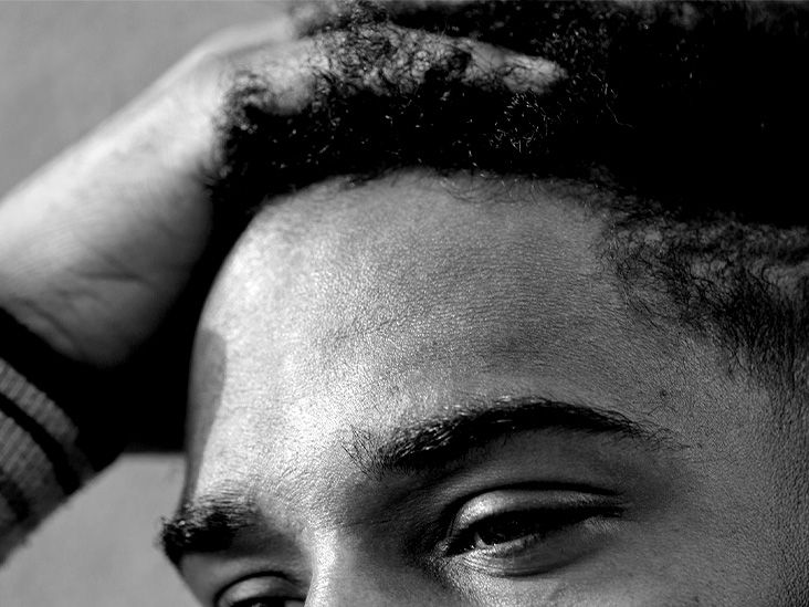 Lupus panniculitis: Symptoms, causes, treatments, and more