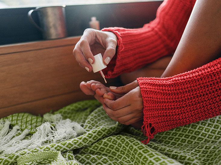 Yellow toenails: Causes and treatment