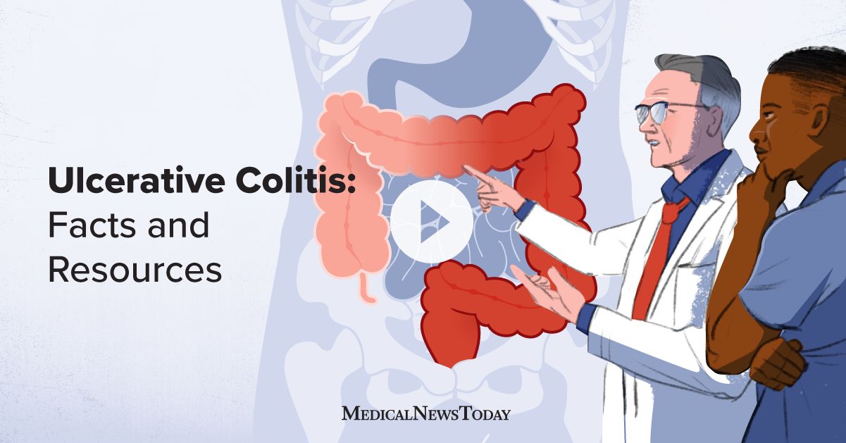 Ulcerative Colitis Videos from Medical News Today