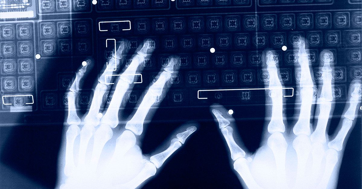 Carpal tunnel misdiagnosis: Common misdiagnoses and next steps