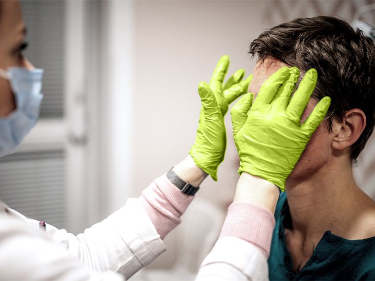 MRSA on face: Appearance, treatment, and more