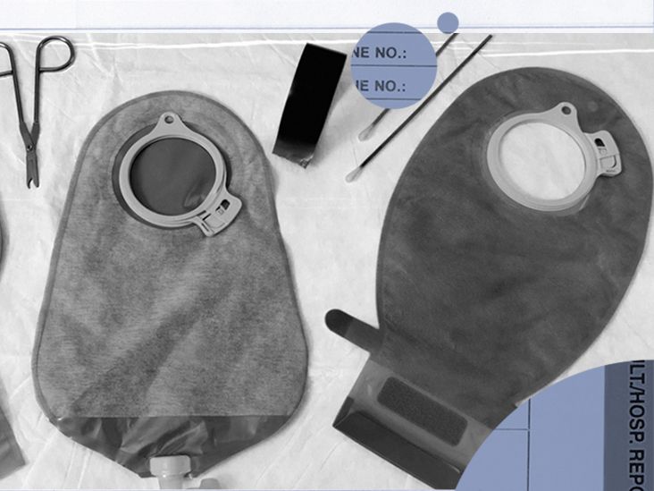 Ileostomy bags: How to care for them