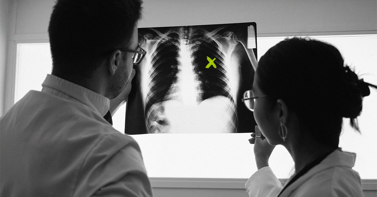 6 possible causes of rib cage pain