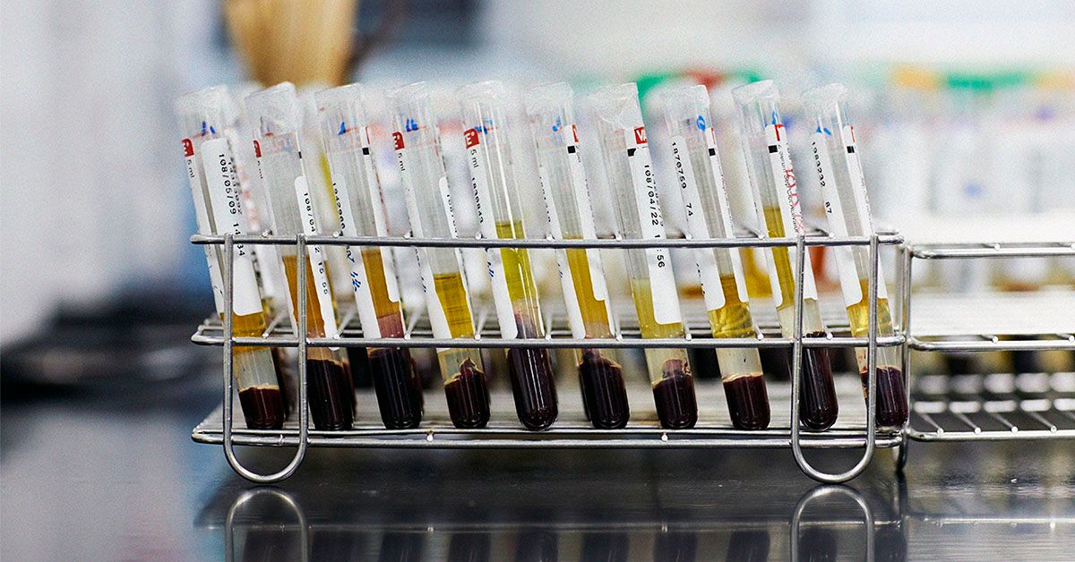 Type C meningitis: What it is, symptoms, and outlook