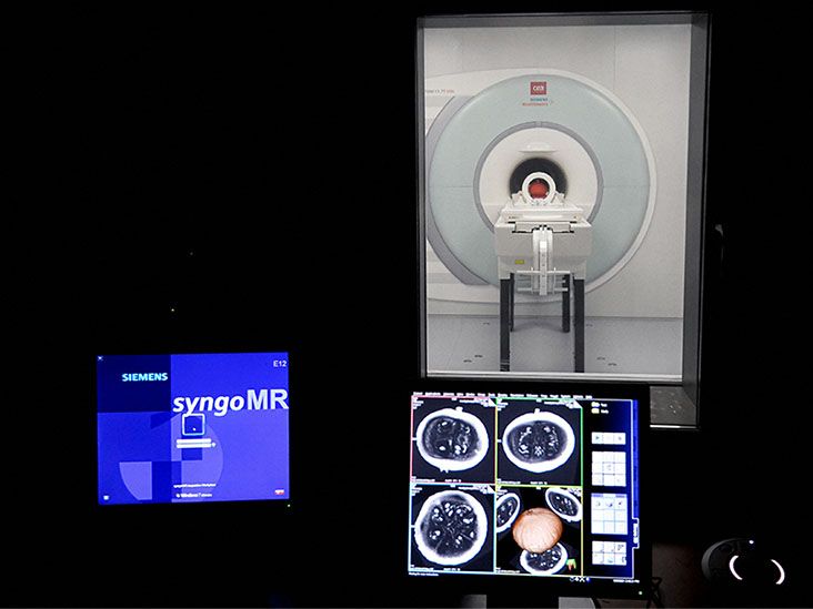 Long COVID: Brainstem damage may cause breathlessness, brain fog