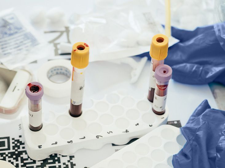 Genetic testing for CML: Types, uses, and more