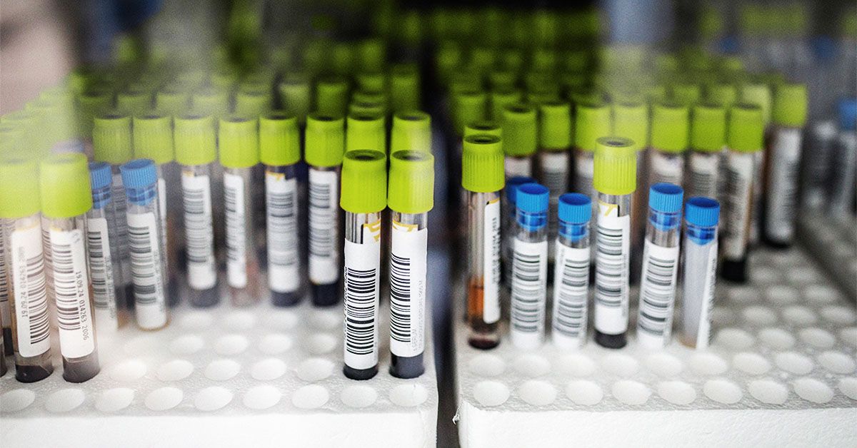 Philadelphia-positive acute lymphoblastic leukemia: A guide