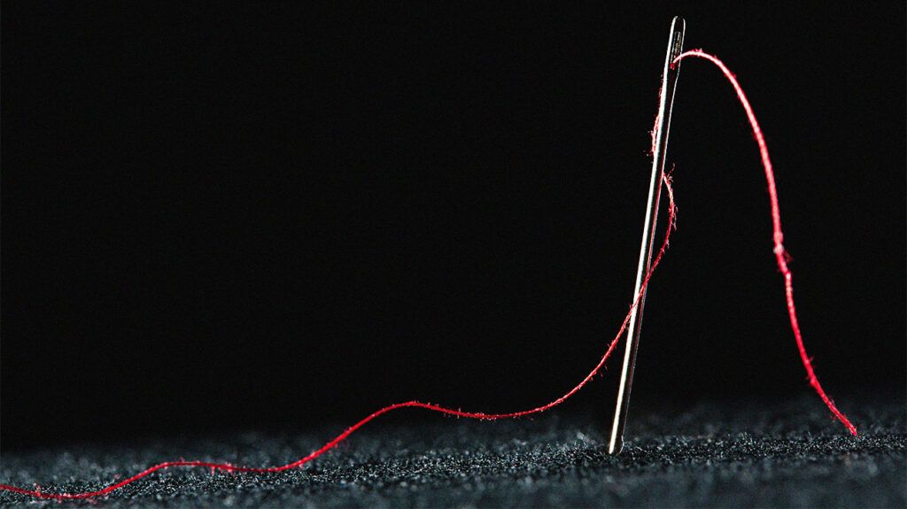 How to remove stitches safely at home