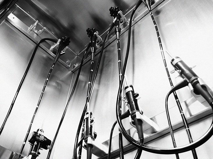 Colonoscopy: Purpose, prep, and procedure