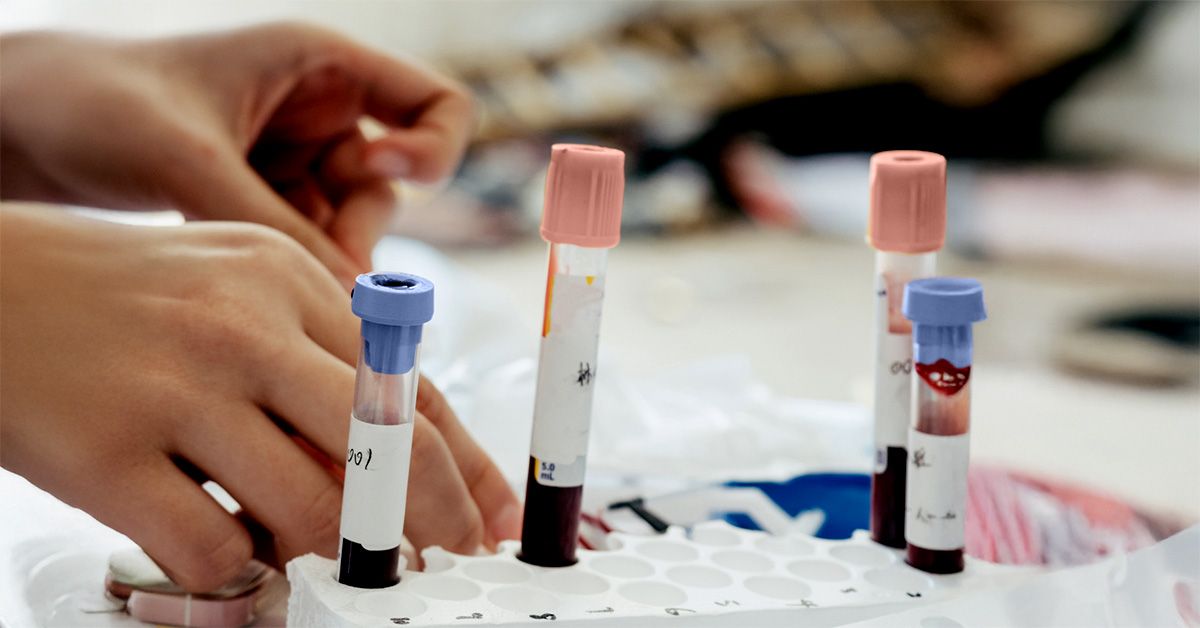 Graves' disease diagnosis: What tests do I need?