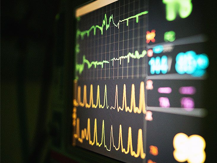 Endocarditis: Symptoms, causes, treatments, and more