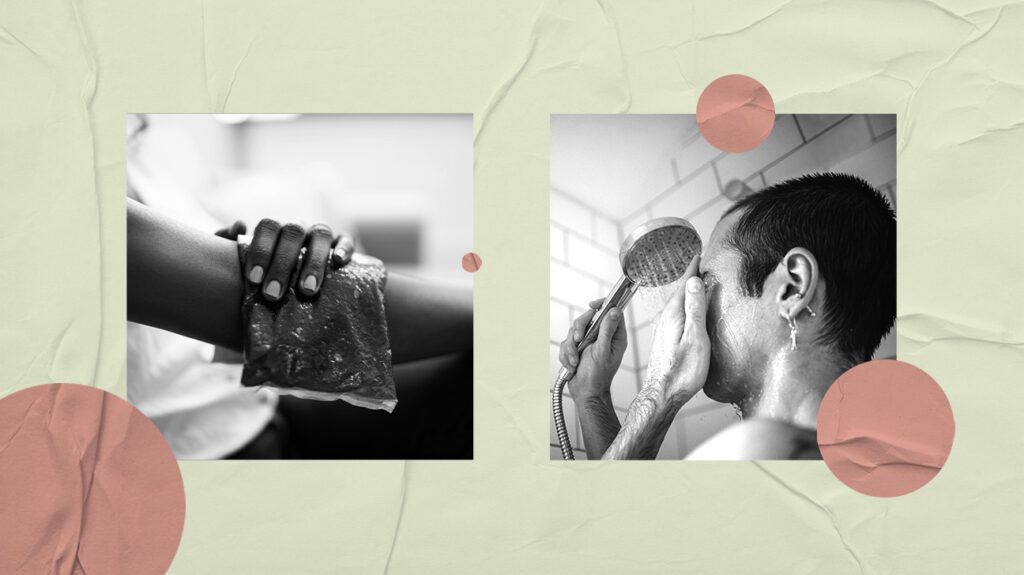 Home remedies for heat rash: 12 natural methods