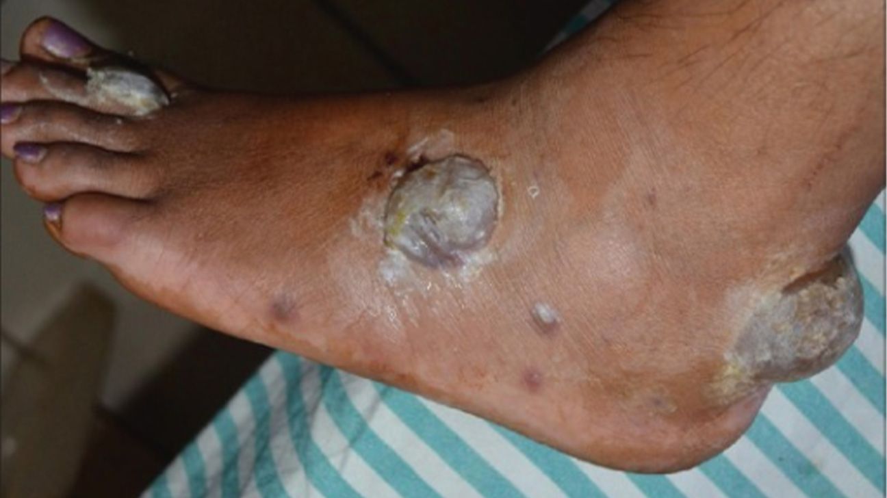 What Is A Skin Rash And How To Treat It Marietta Foot Do I Have