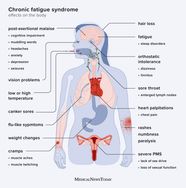 Dizzy And Weak Legs When Standing Up Infoupdate
