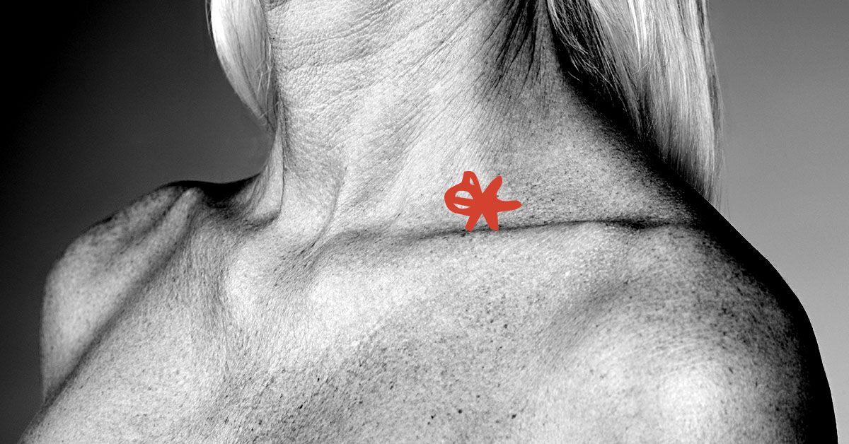 Brachial Plexus Mr Left Supraclavicular Lymph Nodes