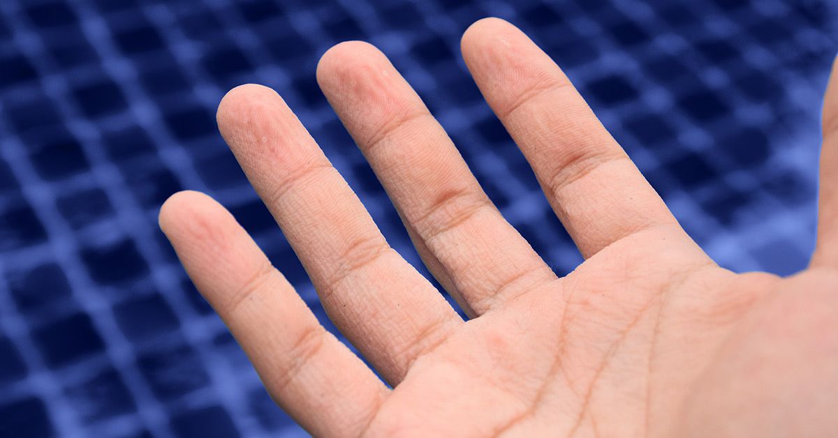 Pruney fingers: Causes, conditions, and treatment