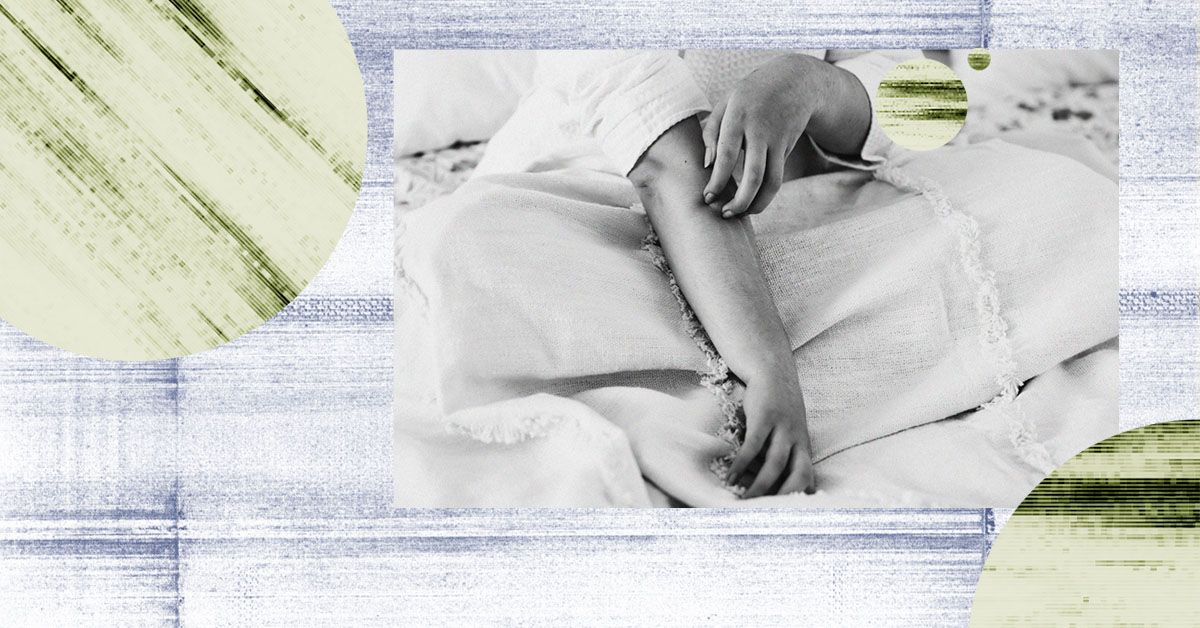 Skin infection pictures and treatments