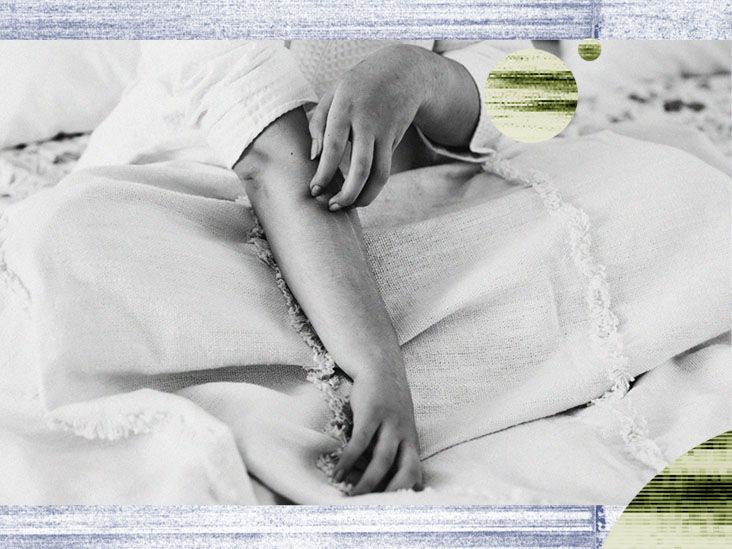 Skin infection pictures and treatments