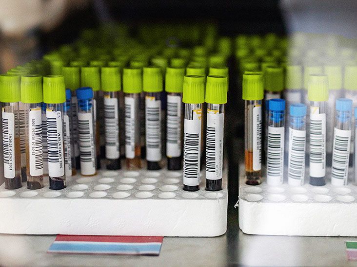 IBD: New test may predict colorectal cancer with 90% accuracy