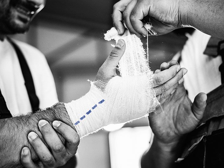 Dissolvable stitches: How long they last, care tips, and removal