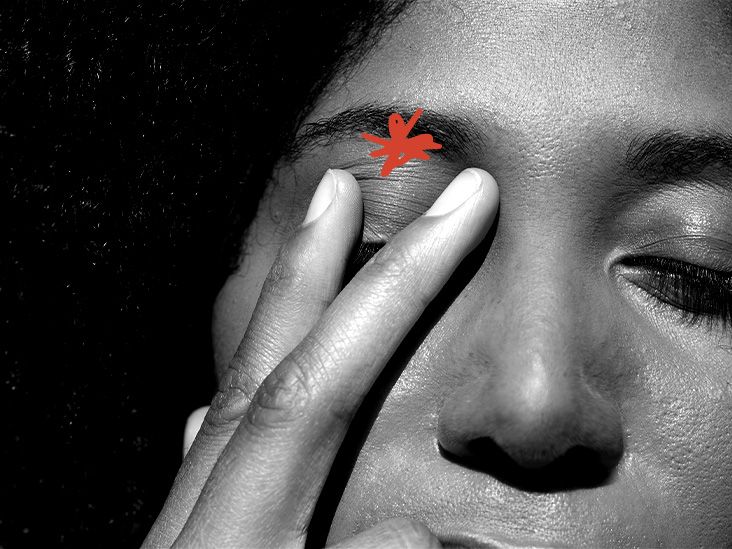 Headache behind the eyes: Causes, treatments, and remedies