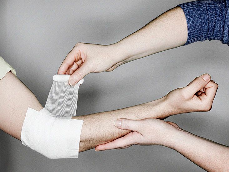 Open wound care: Types, risks, and treatment