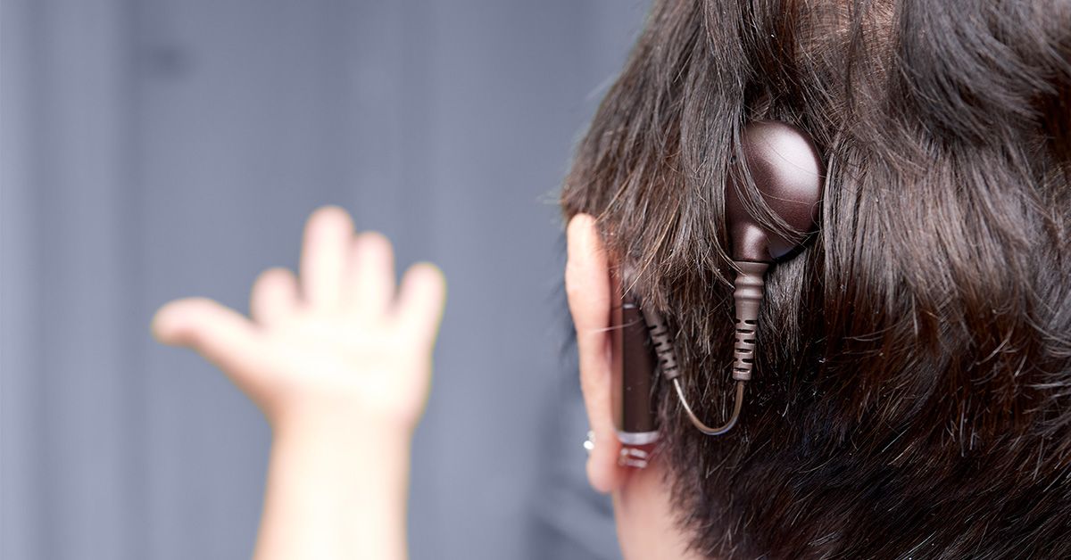 Medicare coverage for cochlear implants: What to know
