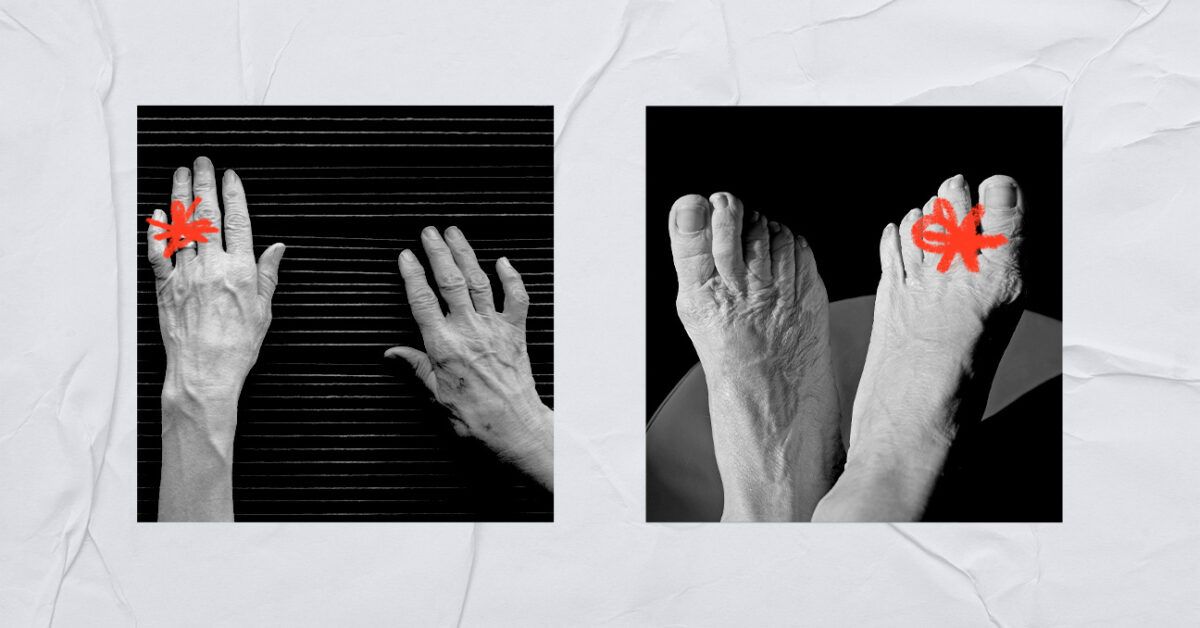 Joints locking up in fingers and toes: Symptoms and more