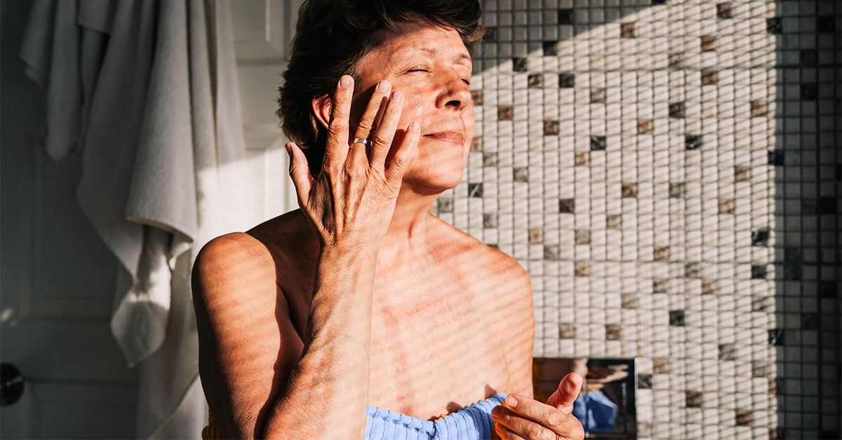 Rheumatoid arthritis rash: Causes, symptoms, and images