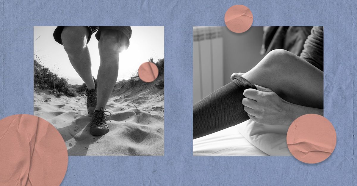 How to reverse venous insufficiency: Lifestyle and medical strategies