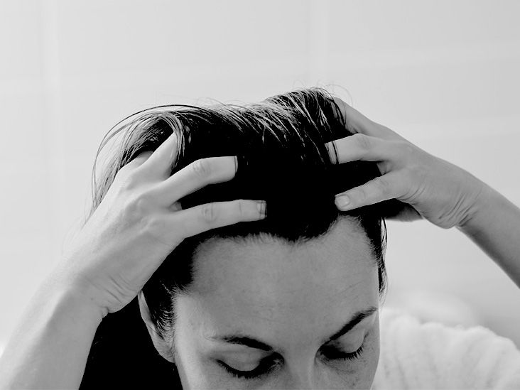 Pictures of sores and scabs on scalp: Causes and more