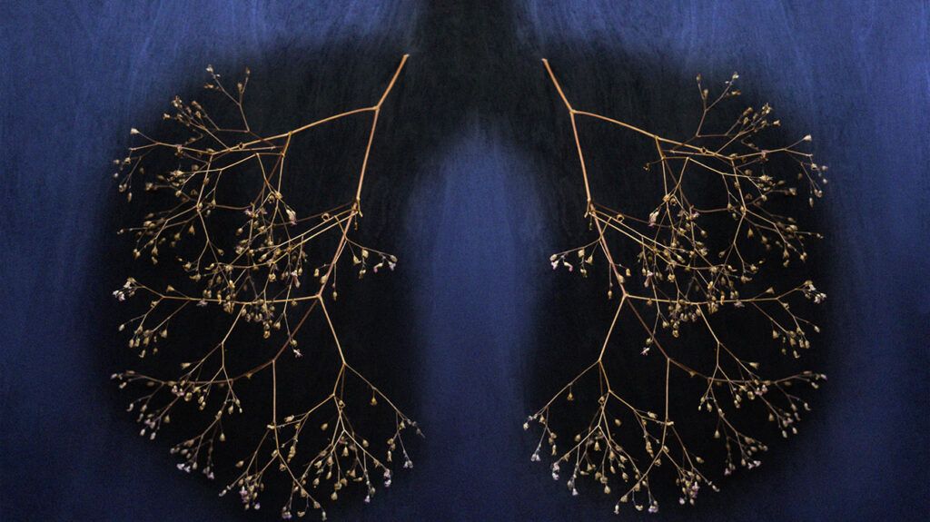 Emphysema prevention: Tips and more