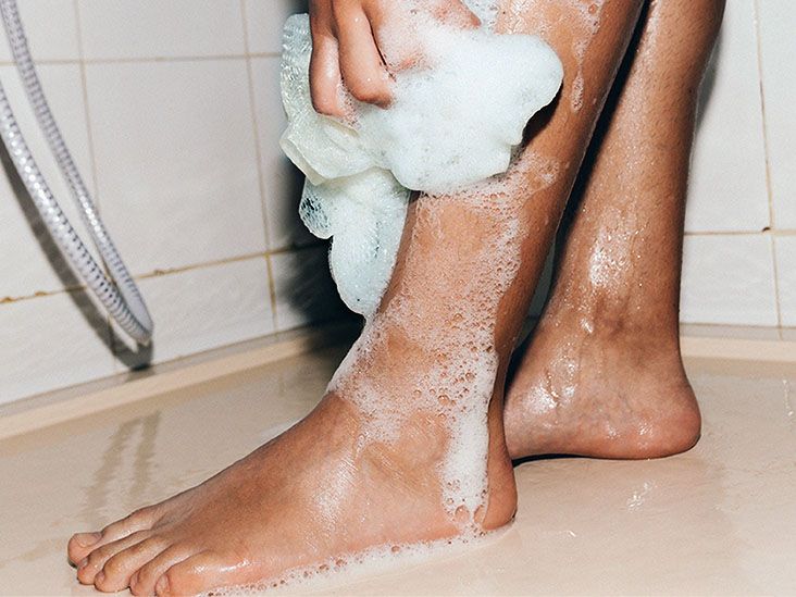 Butt acne: Home and natural treatments for folliculitis