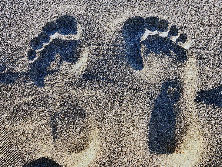 Why are my toes red? Causes, other symptoms, and treatments