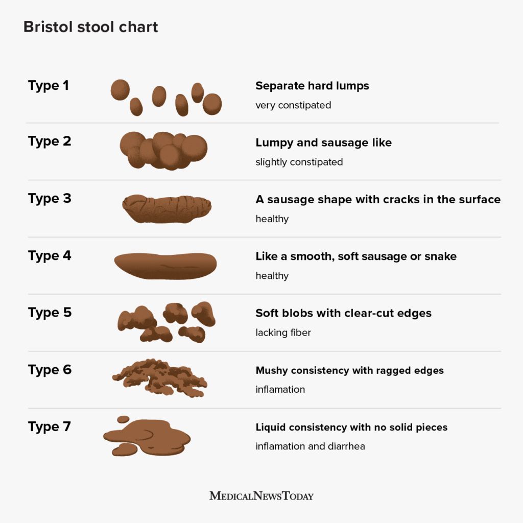 Hard Stool: Causes, prevention, and treatment