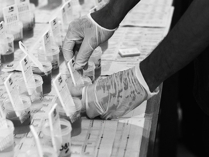 How long does acid stay in your system? Urine, blood, hair, and more