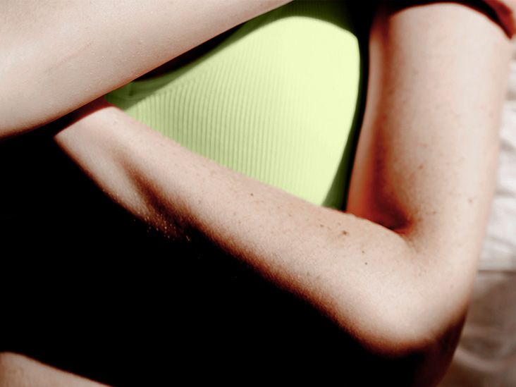 Which autoimmune diseases can cause hives?