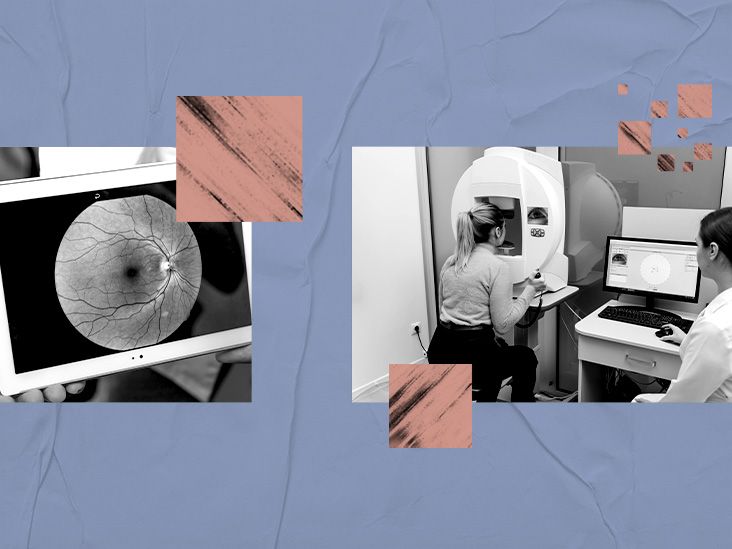 Macular degeneration fundoscopy: What it shows and what to expect