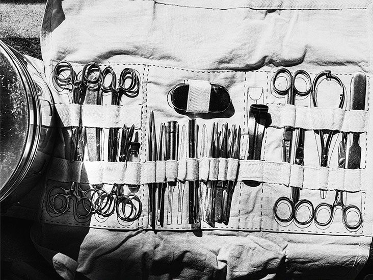 Lobotomy Procedure Do You Need A Lobotomy? Lobotomy Before And After