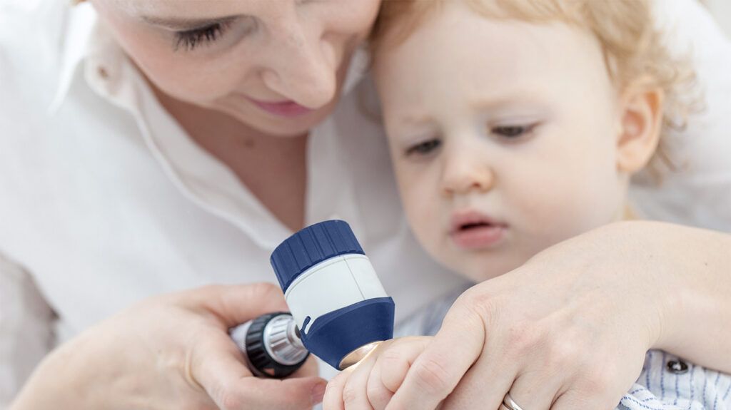 Roseola vs. measles rash: What is the difference?
