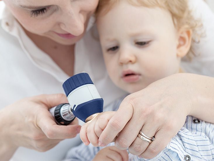 Roseola vs. measles rash: What is the difference?