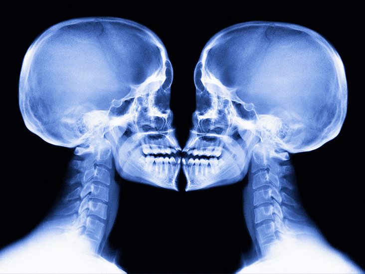 Disc desiccation: Symptoms, causes, and treatments