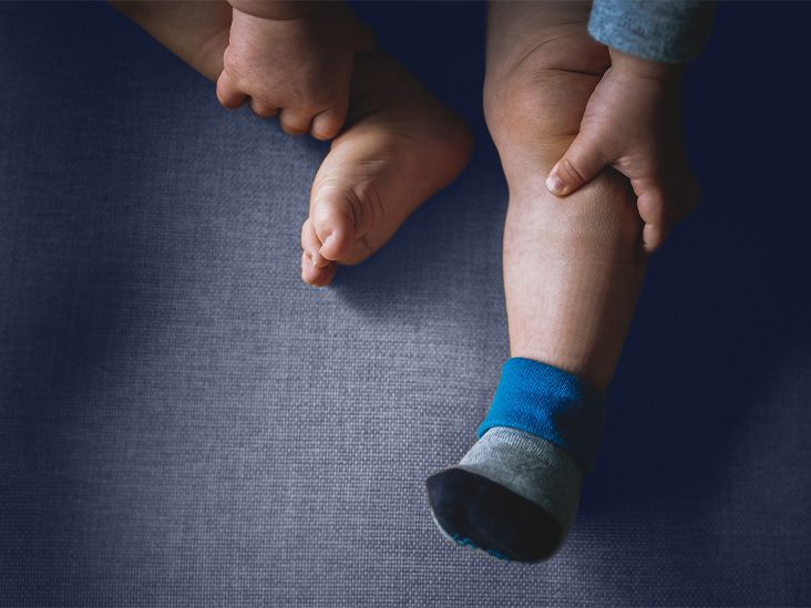 Symptoms of Duchenne muscular dystrophy