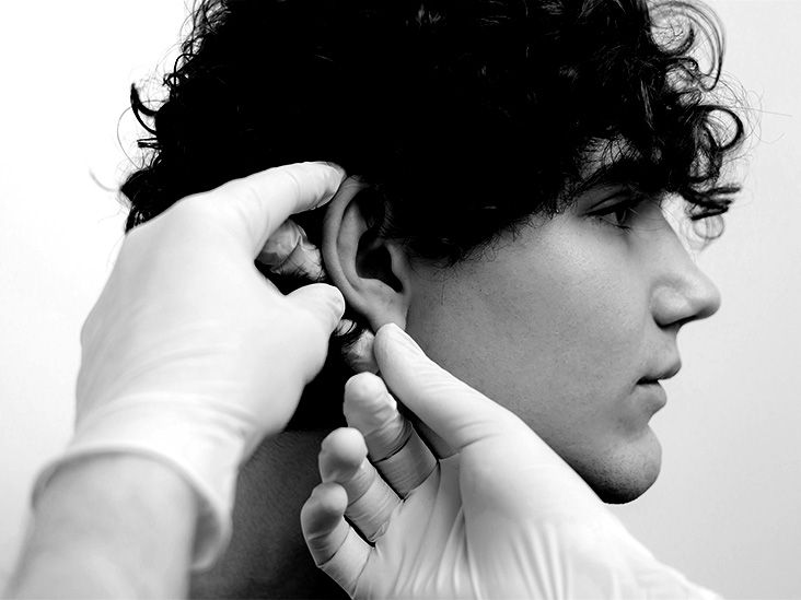 Rash behind ear: Causes, other symptoms, and treatment