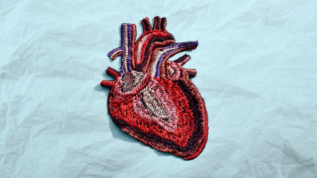 Complications of a heart attack